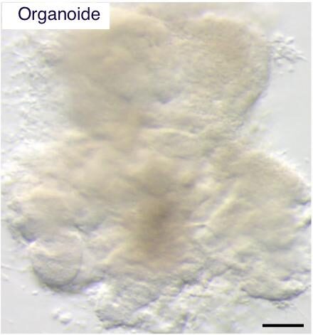 Organoid image viewed under microscope | Español