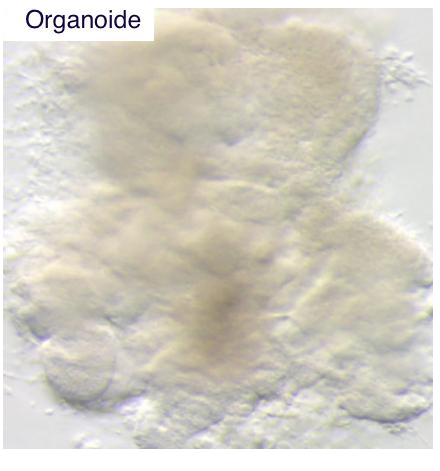 Organoid image viewed under microscope | Español
